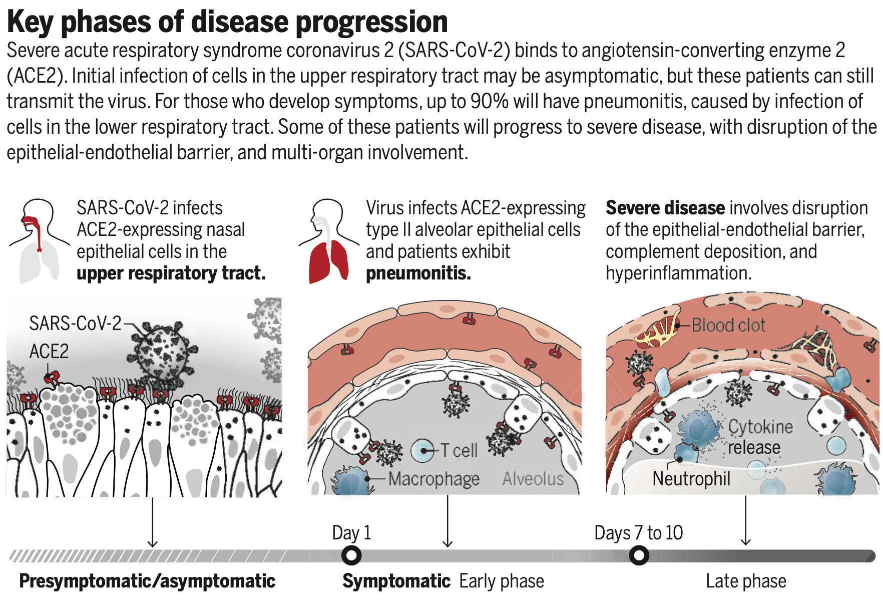 Matheson: How does SARS-CoV-2 cause COVID-19? [Miscellaneous]