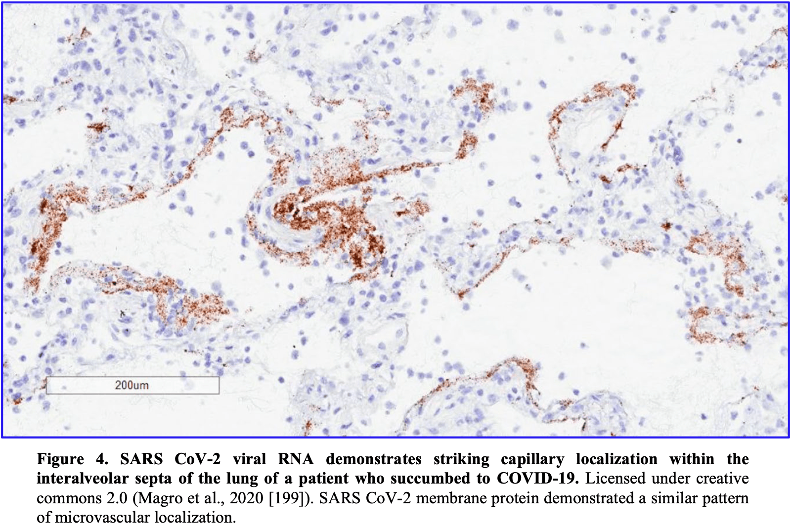 Scheim: From Cold to Killer: How SARS-CoV-2 Evolved without ...